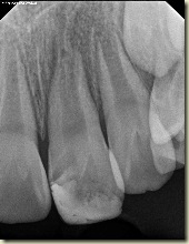 Austin Center for Endodontics, PLLC